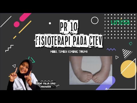 PR 10 TKT Fisioterapi pada CTEV - YouTube