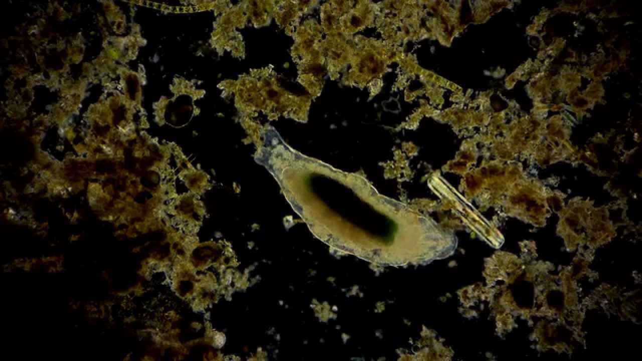 🔬 Bärtierchen - Tardigrada - Tardigrade - waterbears - moss piglets ...