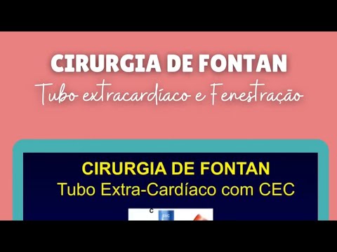 Cirurgia de Fontan