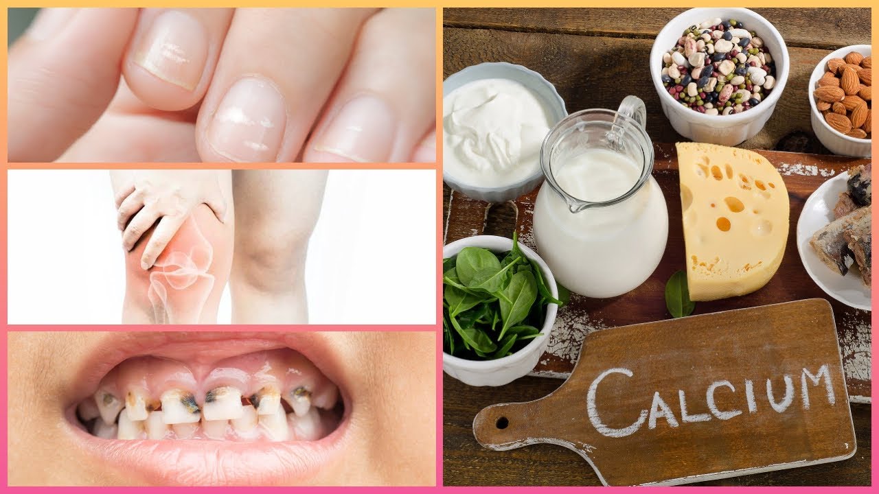 How to cure Hypocalcemia & Calcium Deficiency Symptoms with these ...