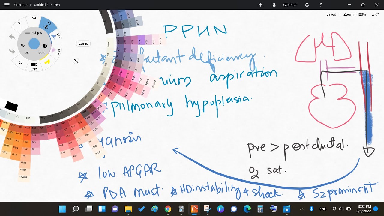 PPHN: Persistent pulmonary hypertension of newborns - YouTube
