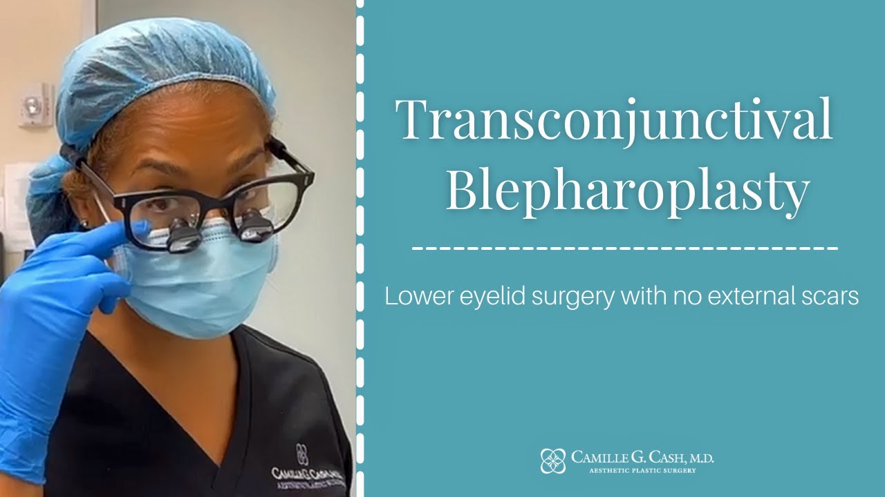 Transconjunctival Lower Blepharoplasty - YouTube