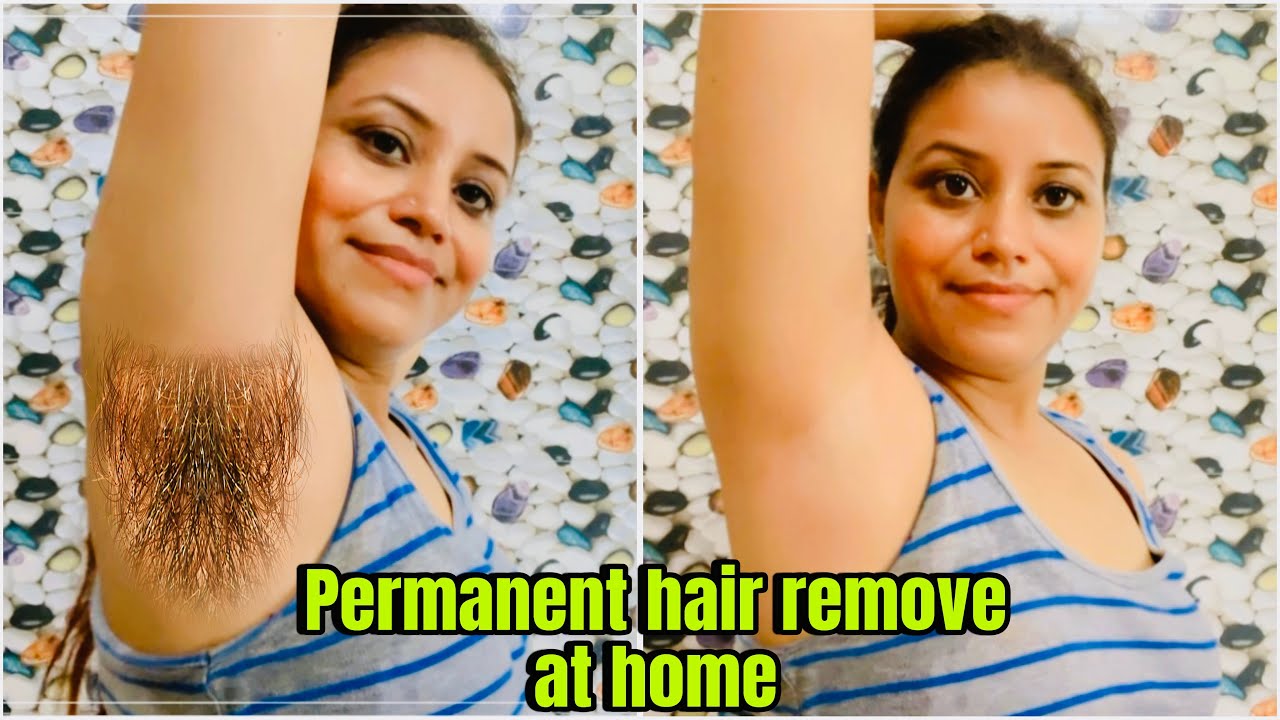 How to remove underarms hair | How i removed my armpit hair permanently ...