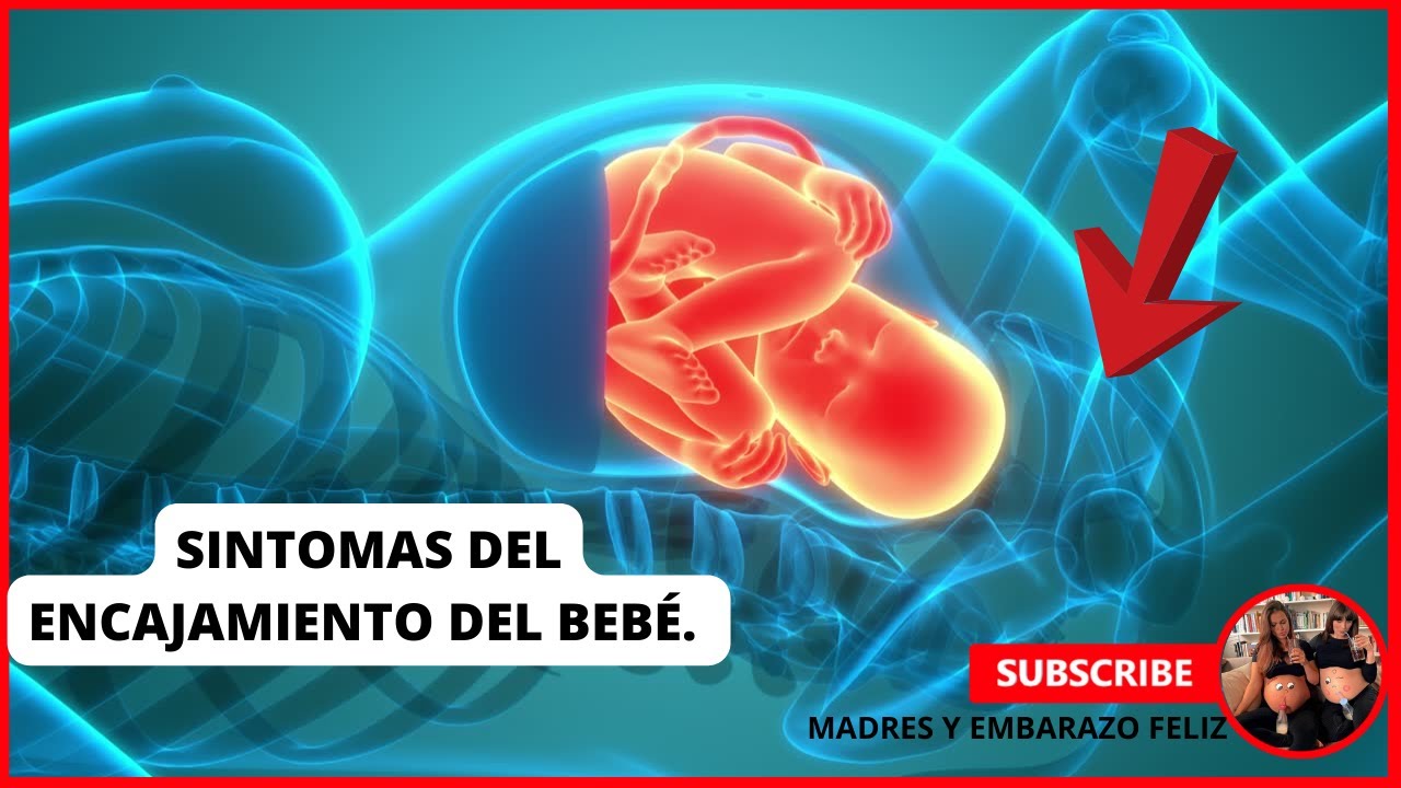 Preguntas y respuestas sobre el encajamiento del bebe síntomas ...