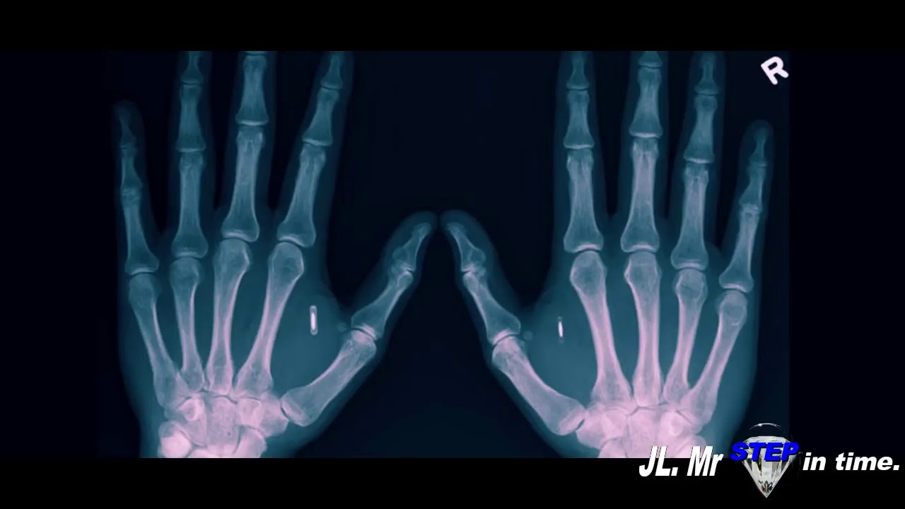 The man that designed the (RFID CHIP) explains - The Mark of the Beast ...