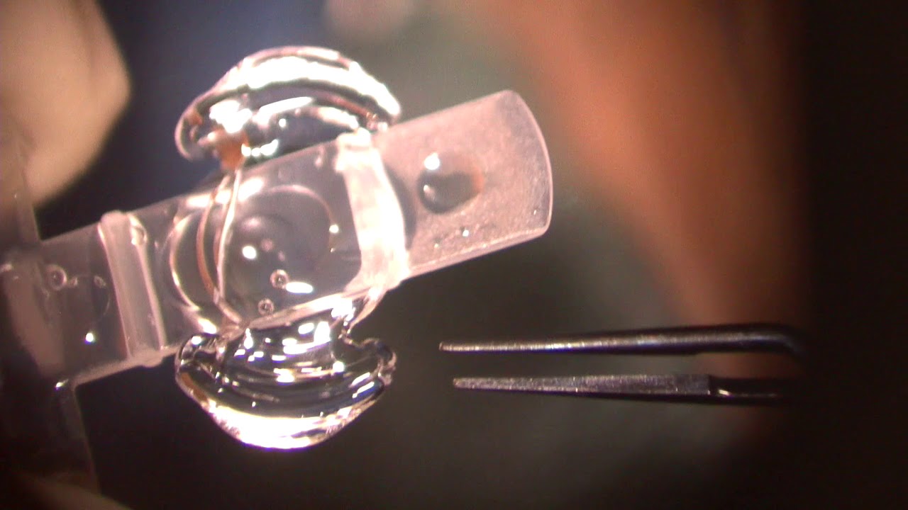 Accommodative Intraocular Lens Implantation: Lumina Akkolens - YouTube