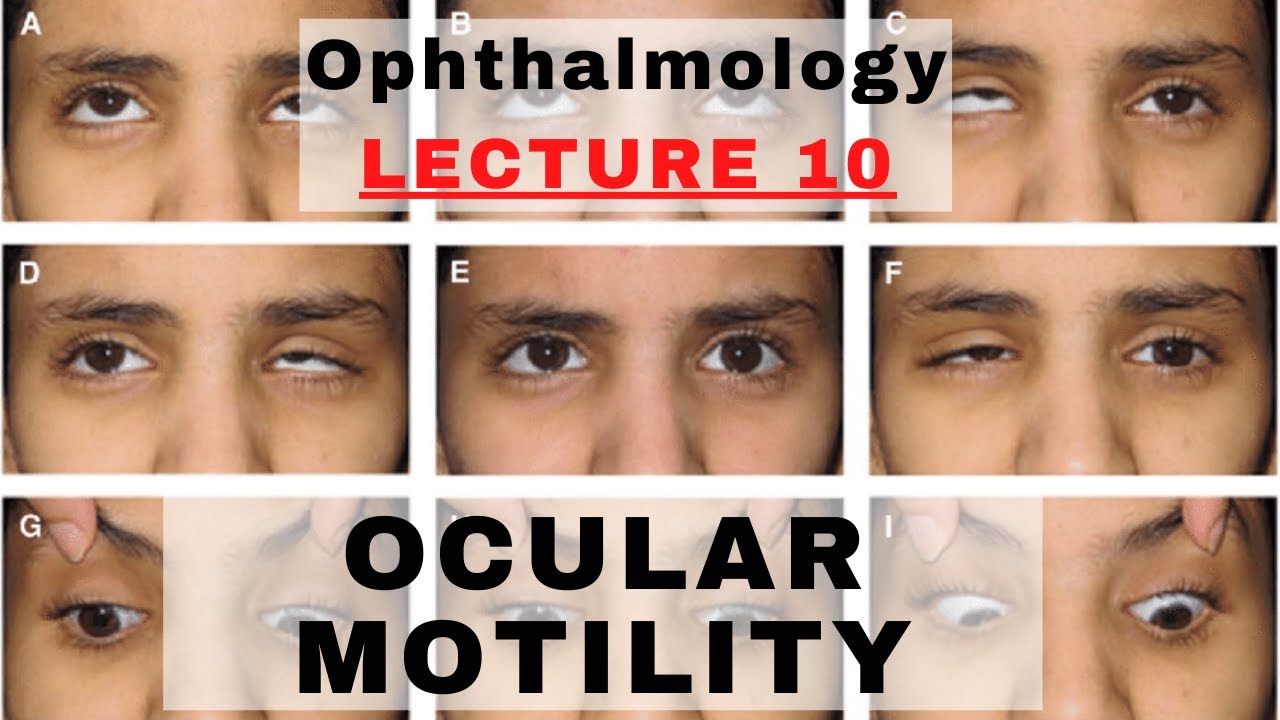 Ocular Motility | Ophthalmology (Lecture 10) - Medicine Revision - YouTube