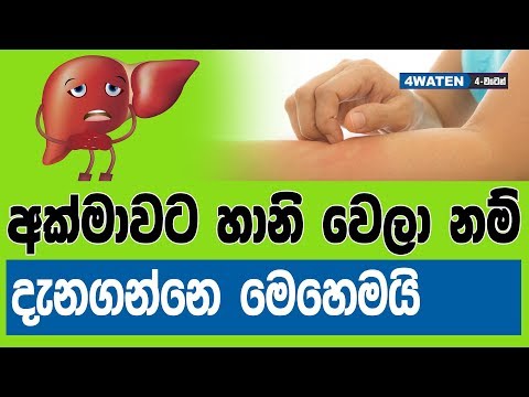 අක්මාවට හානි වෙලා නම් දැනගන්නෙ මෙහෙමයි : How to know your liver is damaging (NEW) 2019