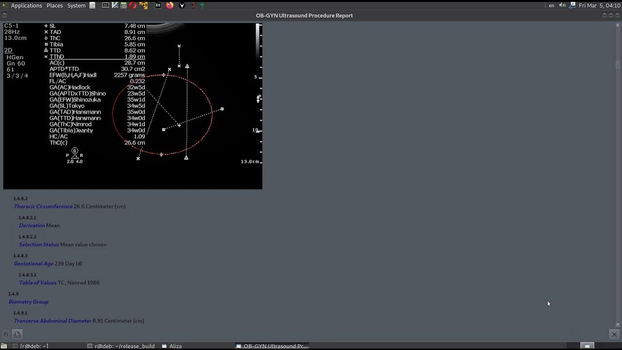 Aliza / Aliza MS DICOM Viewer. Structured Report. - YouTube