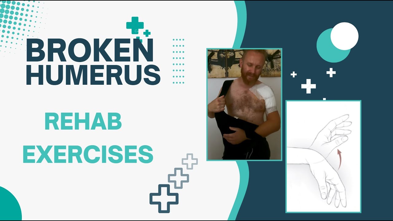 Humerus Fracture - Post Surgery Rehab & Exercises Day 1 - YouTube