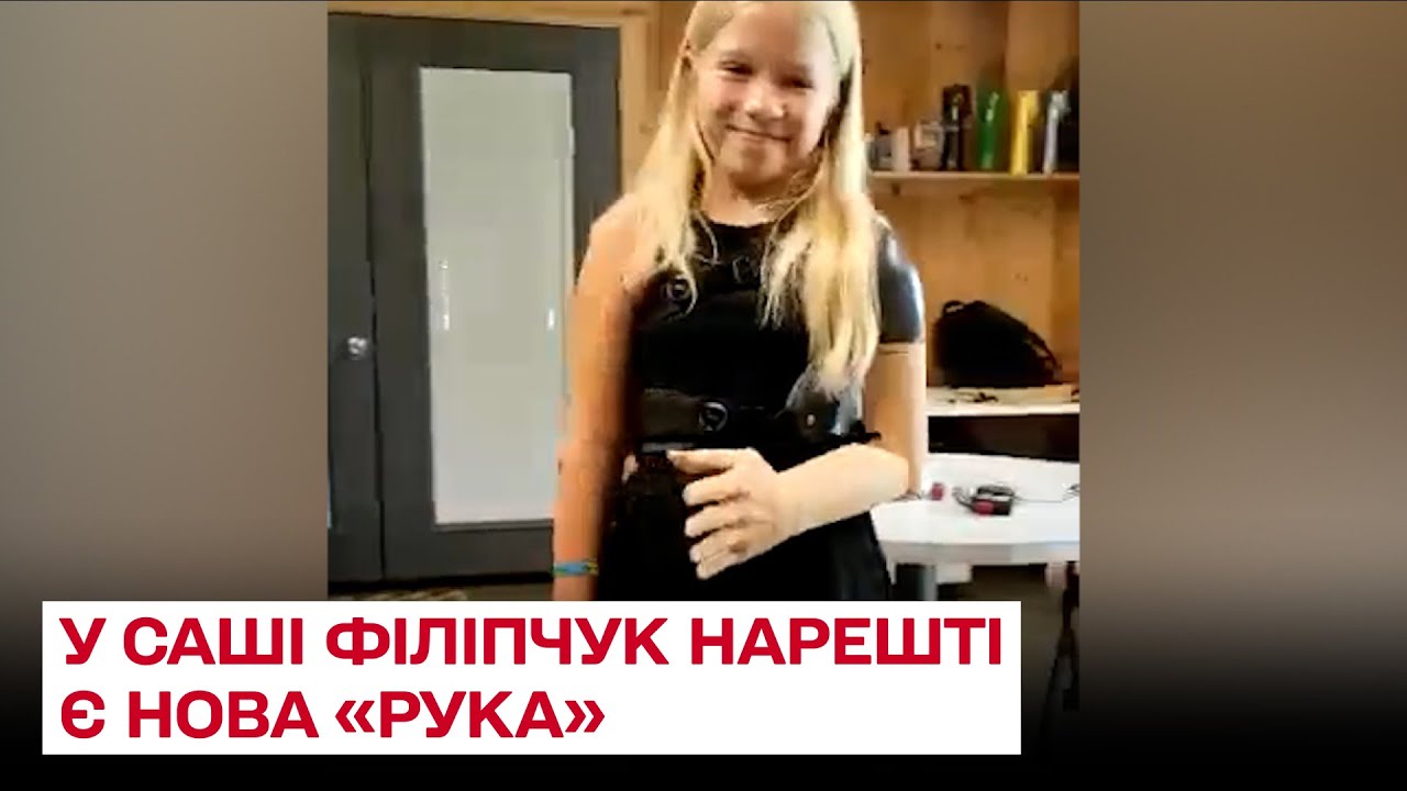 ⚡ Саша Філіпчук з Бучі замість втраченої під час війни руки має штучну ...