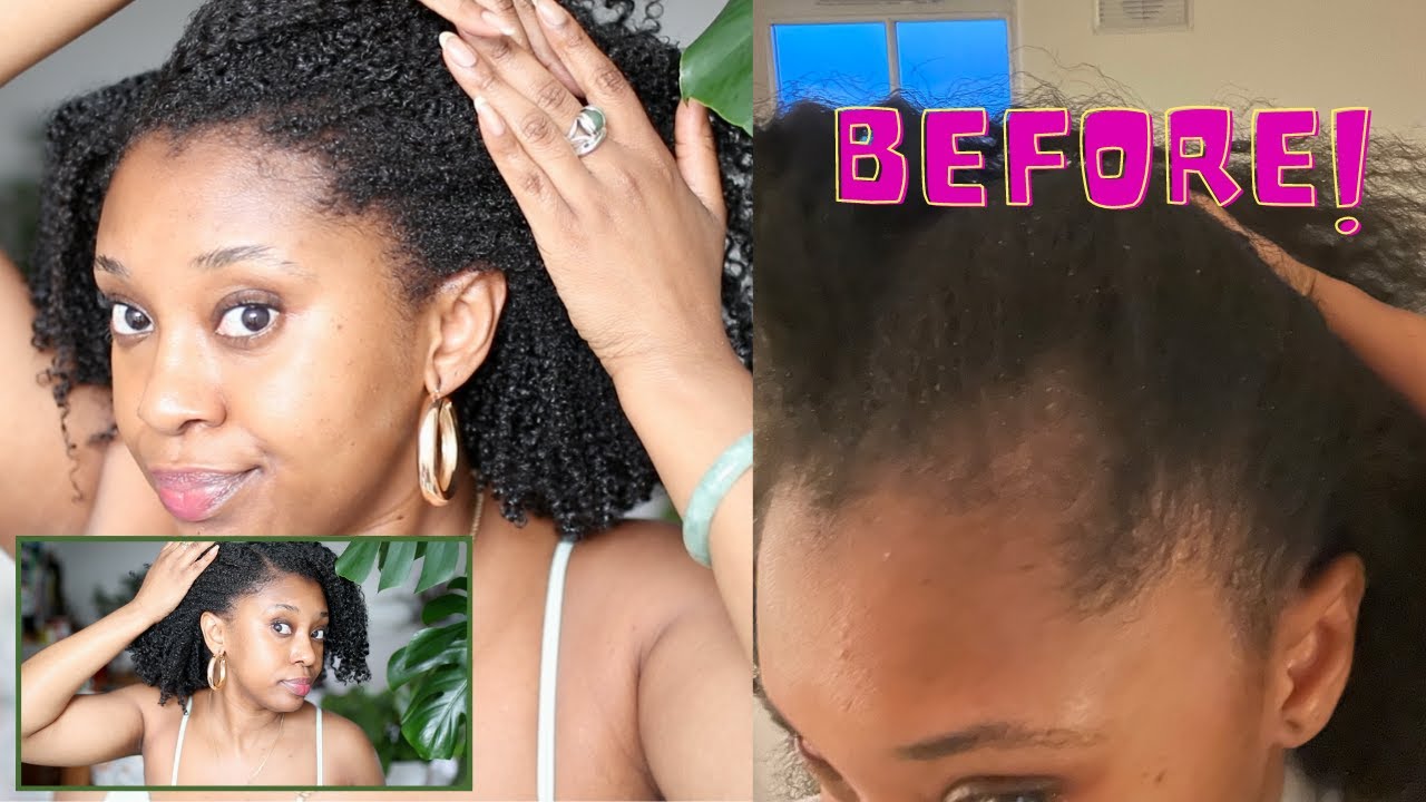 How I grew my edges back AGAIN | Hair Update & What worked - YouTube