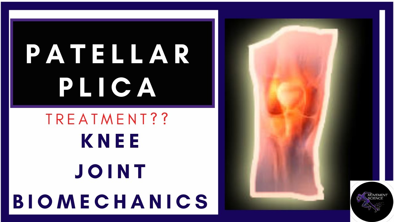 patellar plica syndrome treatment (biomechanics explained ...