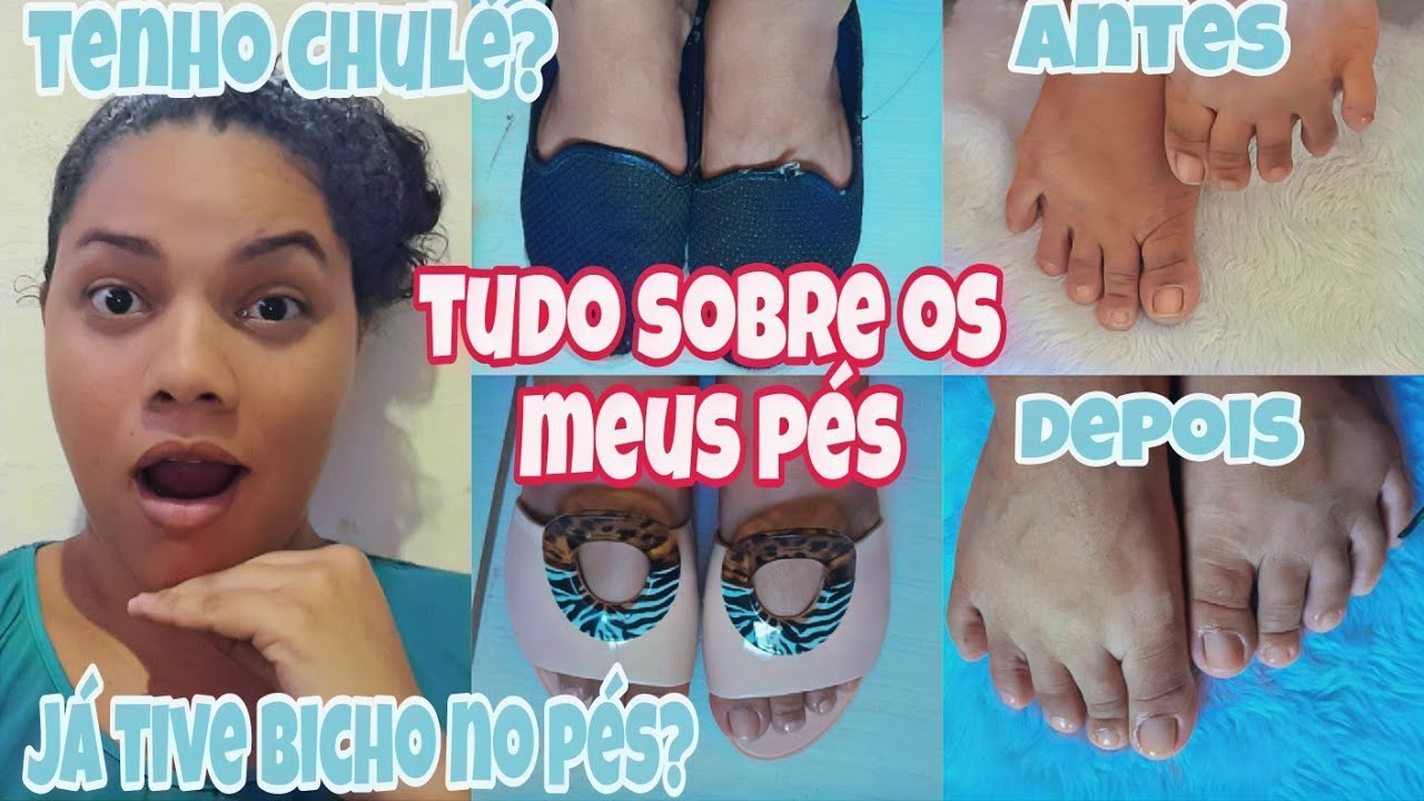 tag dos pés ( tudo sobre os meus pés) já tive bicho de pé? #tags #tag ...