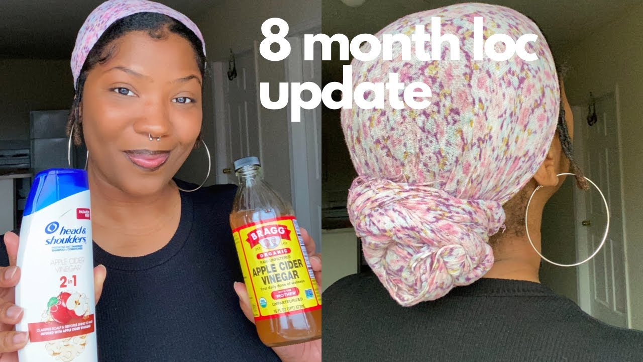 8 month loc update🌱|head wraps, acv rinse, & dandruff - YouTube