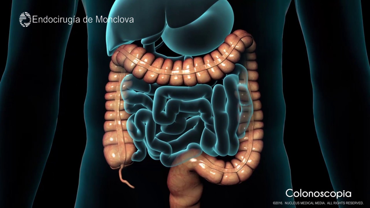 Colonoscopia - YouTube