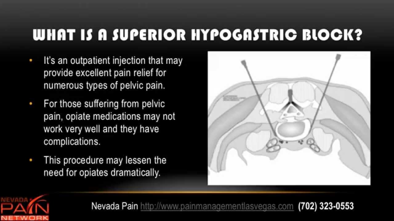 Superior Hypogastric Plexus Block Explained by a Las Vegas Pain Center ...