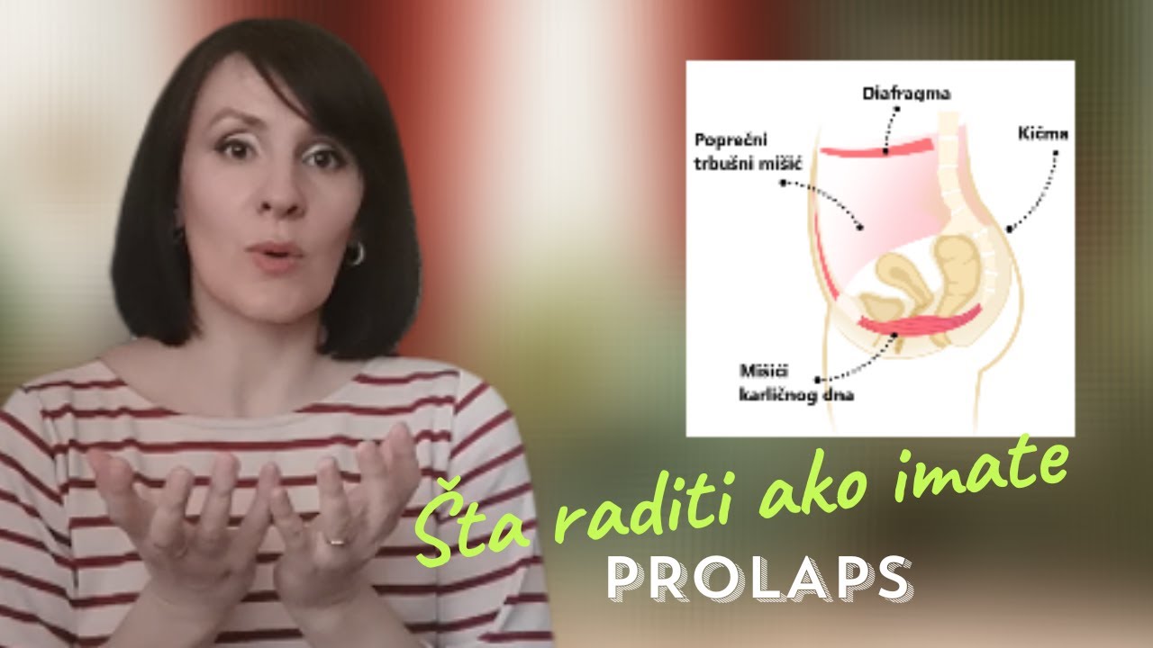 Spustila se materica - šta treba raditi? Obratite na ovo pažnju ako imate prolaps - YouTube