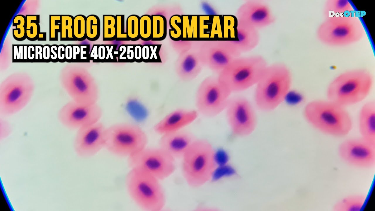 35. Frog Blood Smear (Microscope 40x-2500x) - YouTube