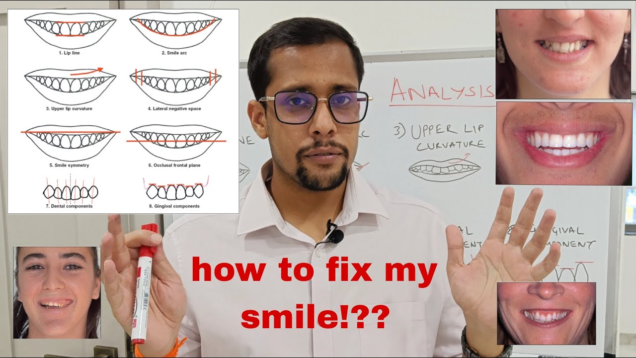 how to correct my smile! | smile check in 5 mins | smile correction ...