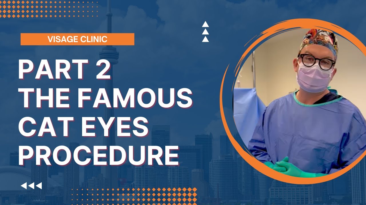 Part 2: Cat Eyes Procedure | Visage Clinic Toronto - YouTube