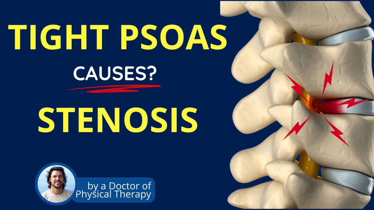 Stenosis, Psoas Muscle Tightness & Lower Back Pain | Causes - YouTube