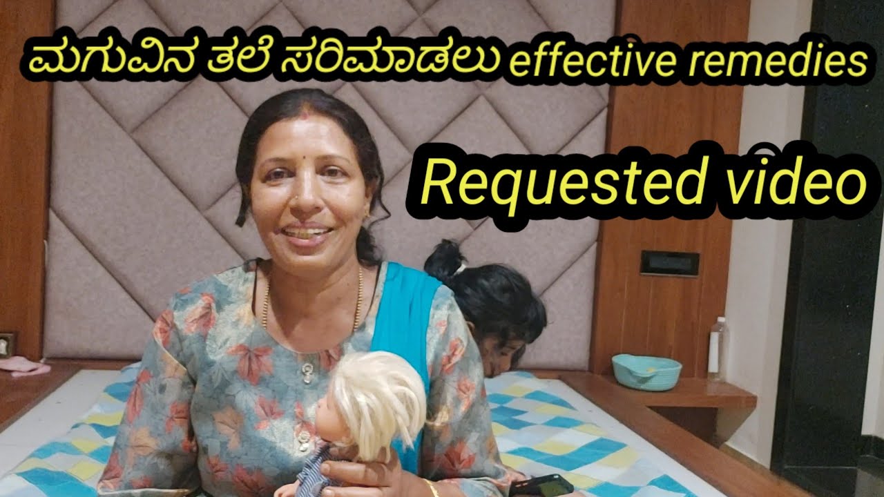 ಮಗುವಿನ ಉದ್ದ ತಲೆ ಸರಿಮಾಡುವ (Cone shape head) ಅದ್ಬುತ ಉಪಾಯಗಳು #remedies for ...