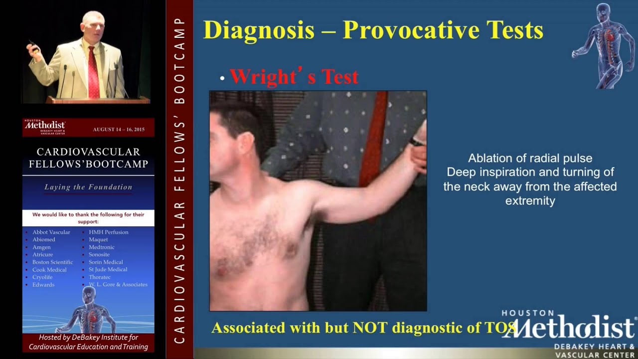 Diagnosis and Imaging of TOS and Upper Extremity Disease (Mark Mattos ...