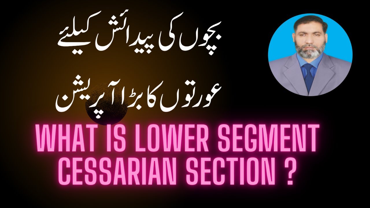 What is lower segment cesarean section (LSCS), C Section - YouTube