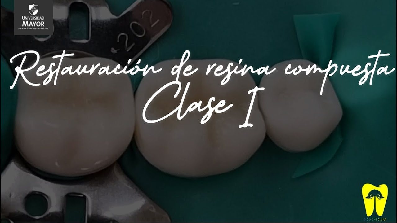 Restauración de resina compuesta clase I | Paso a paso - YouTube