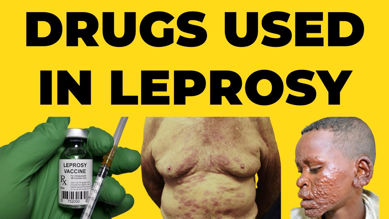 Drugs used in leprosy || Diagnosis and Treatment | Hansen's Disease ...