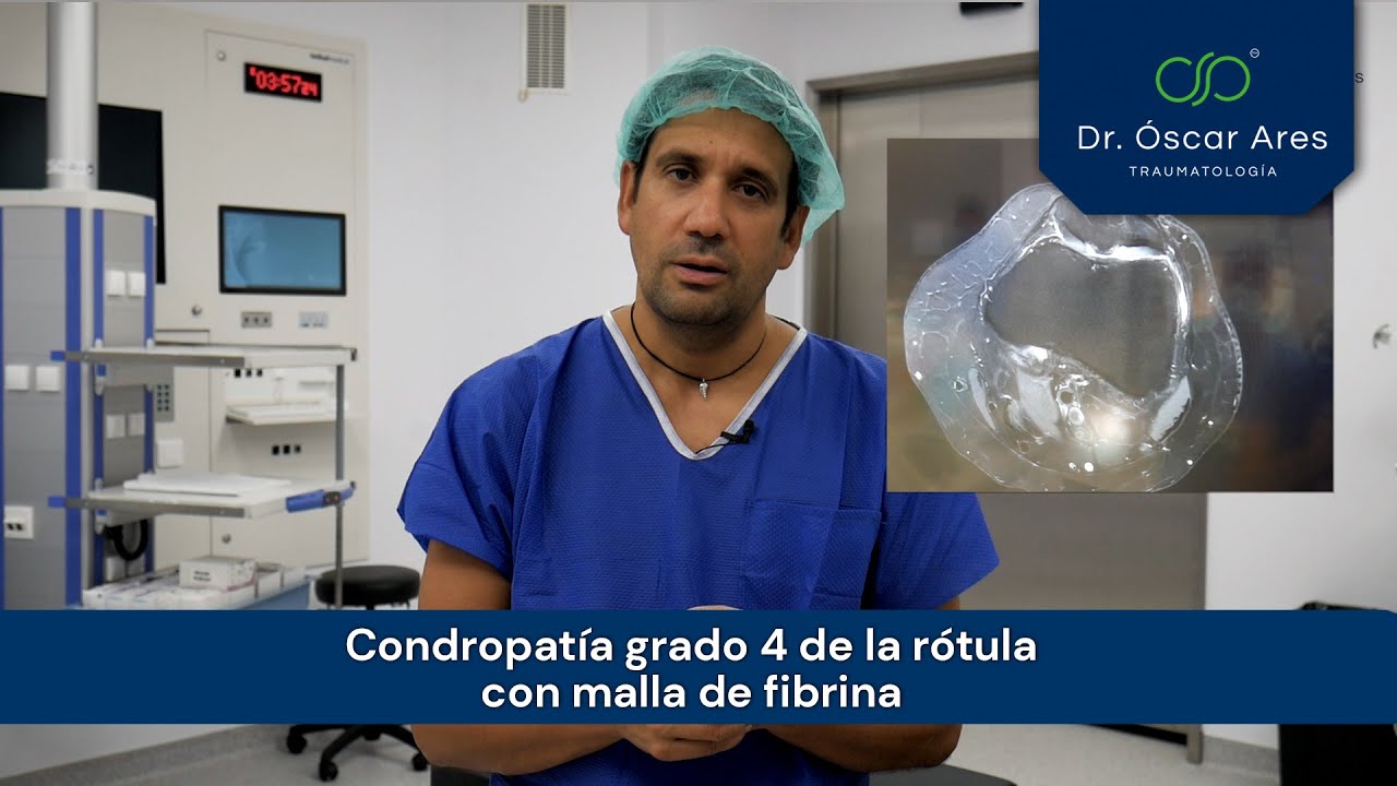 Condropatía grado 4 de la rótula con malla de fibrina - Dr. Ares - YouTube