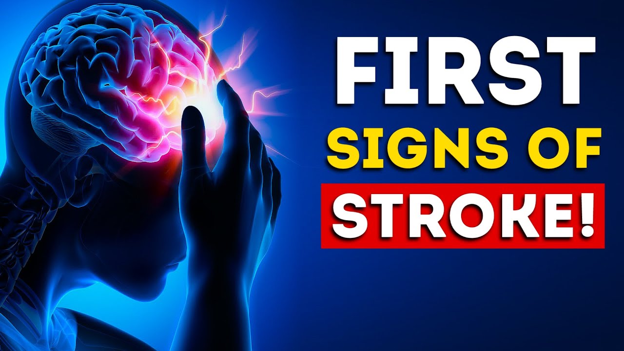 Here's What To Do During A Stroke (Everyone Needs To Know This) - YouTube