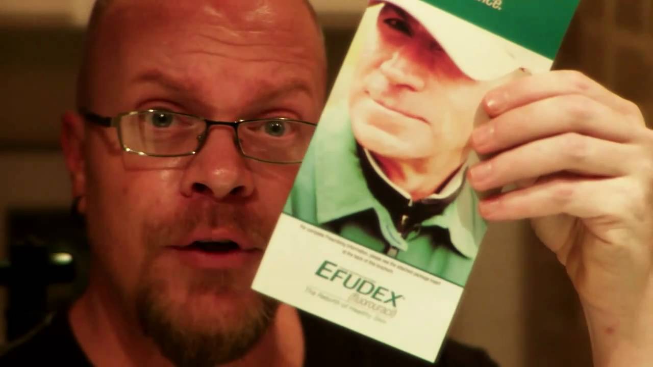 Ray's Efudex Treatment Video - YouTube