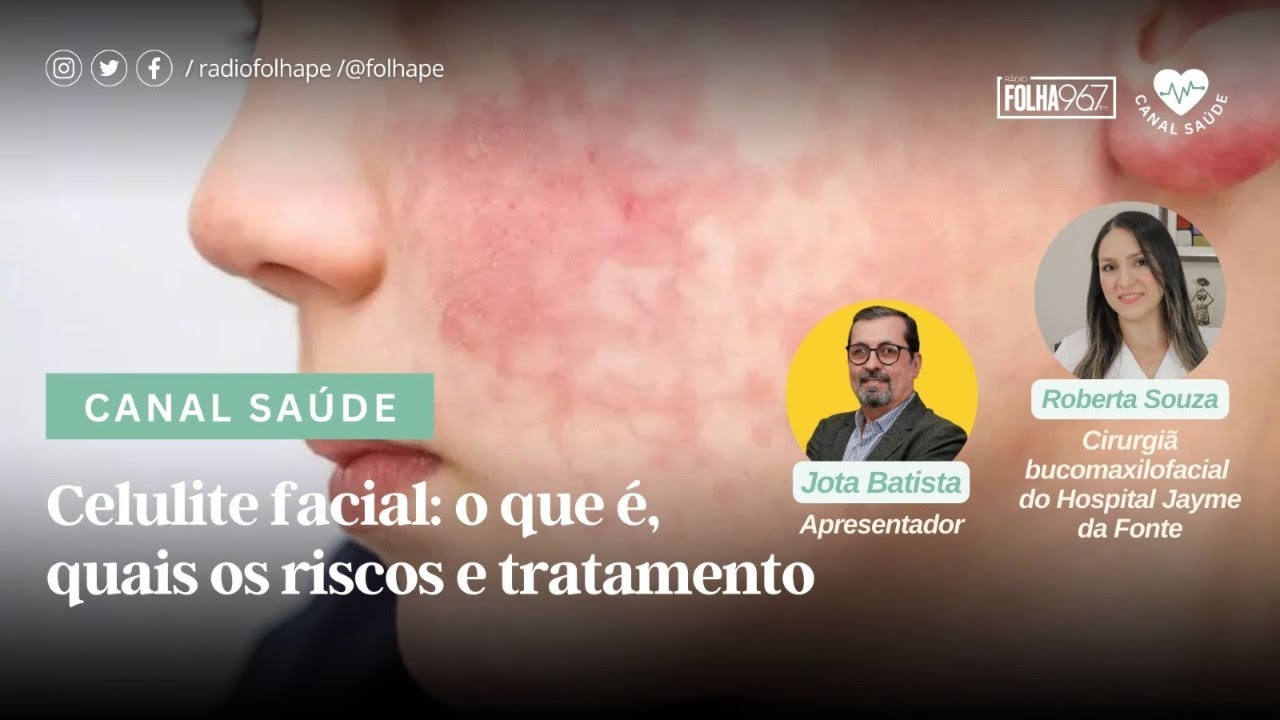 CANAL SAÚDE | CELULITE FACIAL: O QUE É, QUAIS RISCOS E TRATAMENTO - YouTube