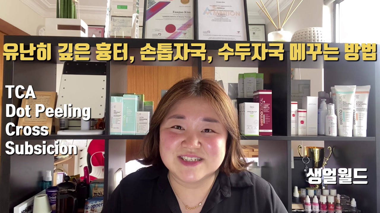 유난히 깊은 흉터, 손톱자국, 수두자국 치료방법 TCA, Dot peeling, Subsicion(eng) - YouTube