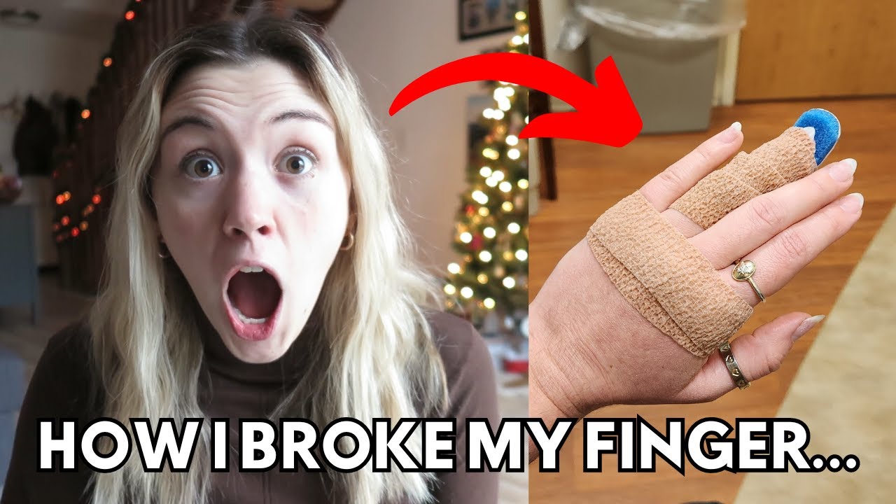 STORYTIME: How I Broke My Finger... || vlogmas day 7 - YouTube