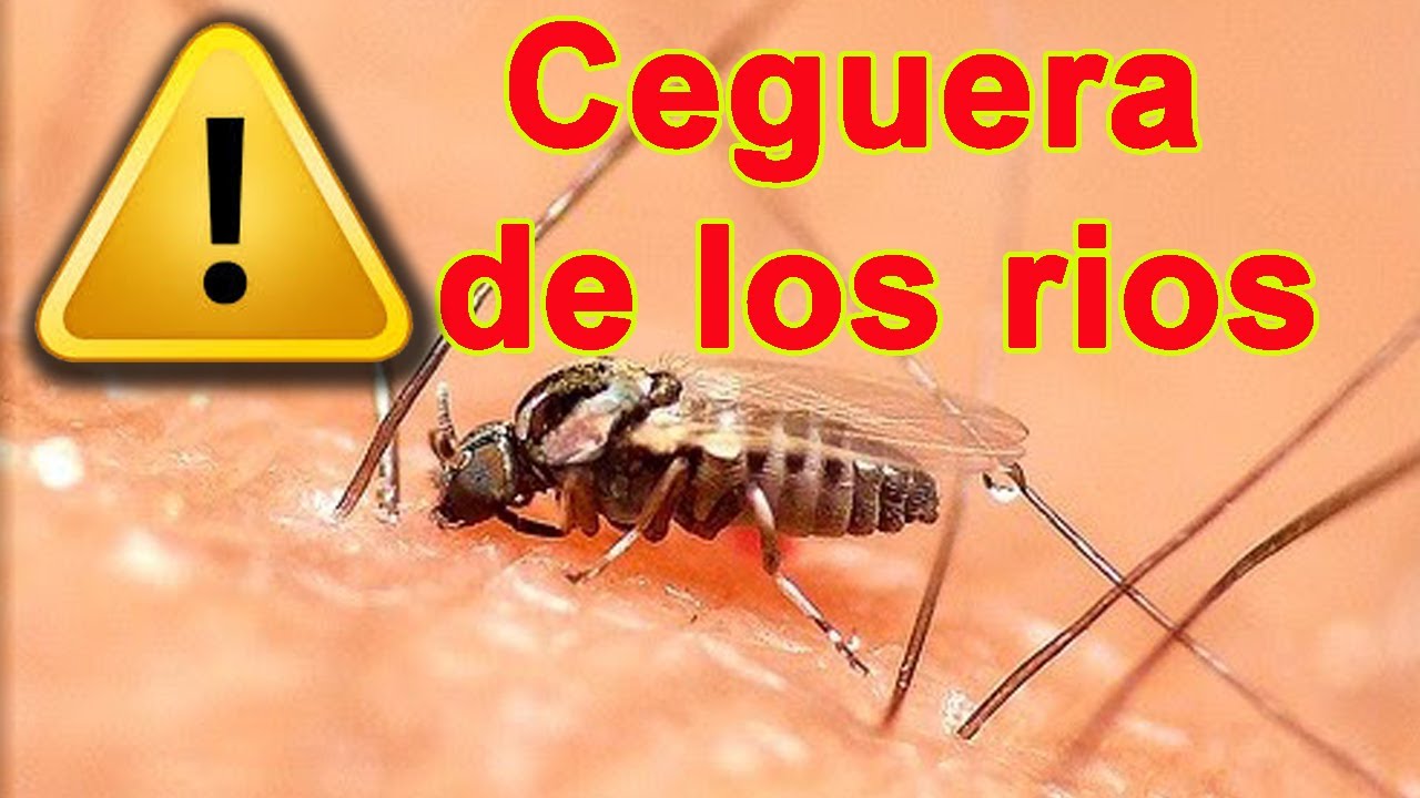 Cuales son los sintomas de la oncocercosis ( ceguera de los rios ...