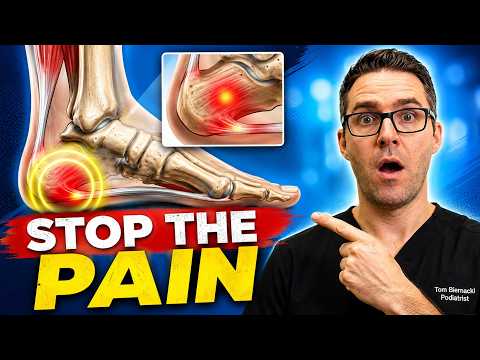 Heel Spur Mistakes That Make Pain Worse