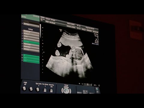 20 week anatomy scan | vlogmas - YouTube