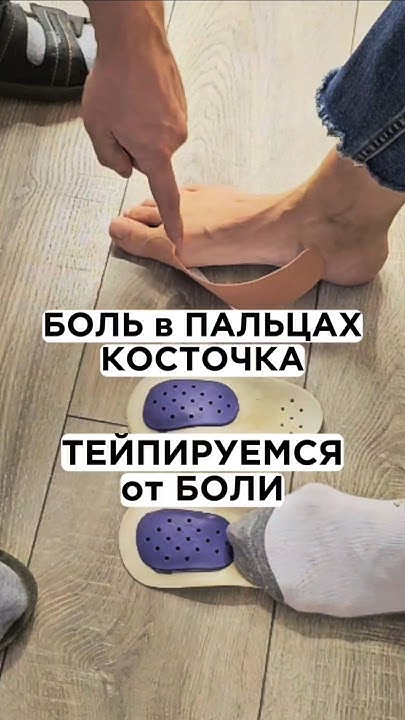 Тейпируемся при Косточке на Ноге и от БОЛИ в Пальцах #косточка #вальгус ...