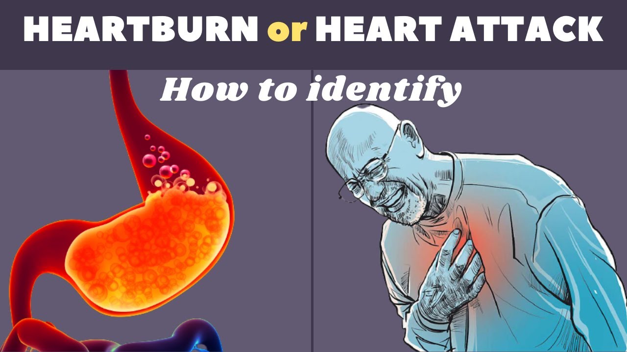 Heart attack or Heartburn | Heart attack symptoms | Acid reflux ...