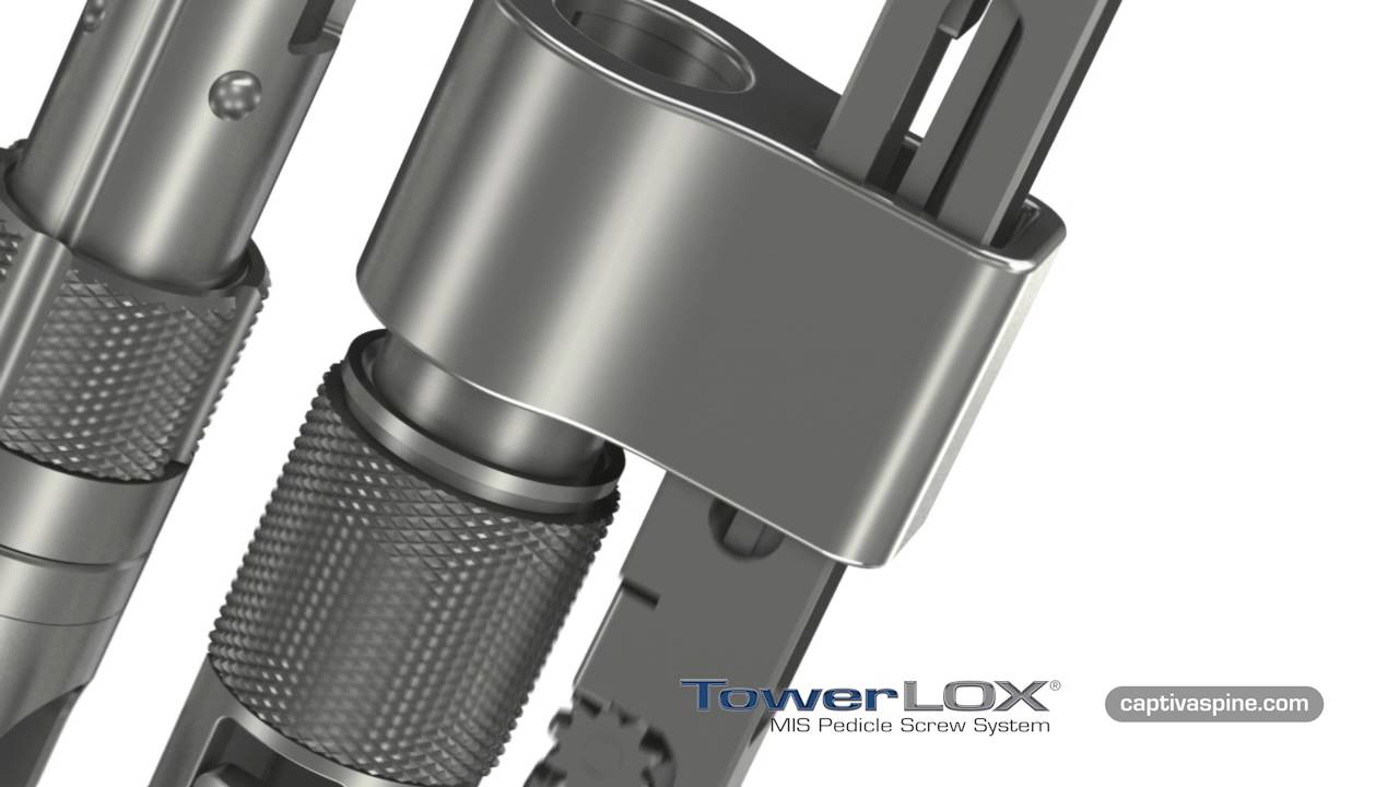 Captiva Spine's TowerLOX MIS Pedicle Screw System - PivoQuik Inserter ...