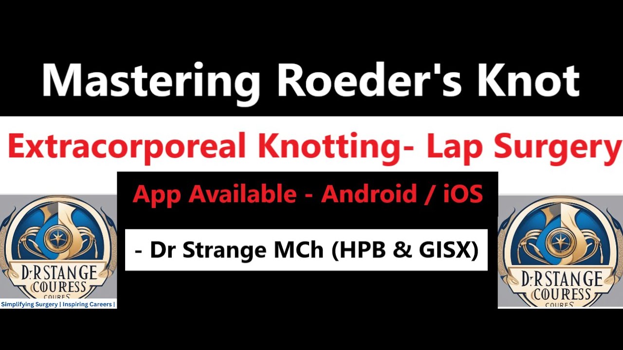 Vid 2.1 - Roeder's Knot: Master Extracorporeal Knotting in Lap Sx. (UHD ...