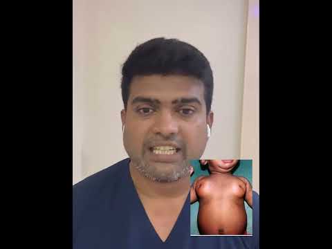 What not to be done by Malishwali bai in newborn | Can i extract milk from baby breast?