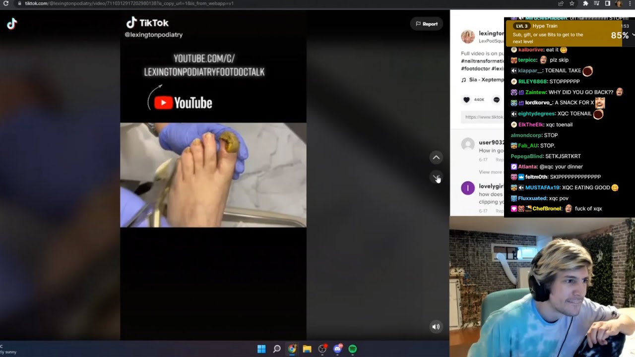 xQc reacts to death rot toe nail Tik Tok - YouTube