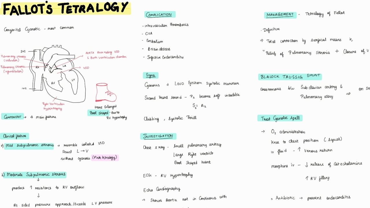 Tetralogy of Fallot - Congenital Heart disease - YouTube