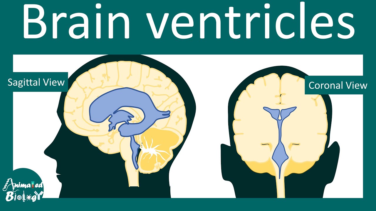Brain ventricles | Cerebrospinal Fluid flow | Hydrocephalus | USMLE ...