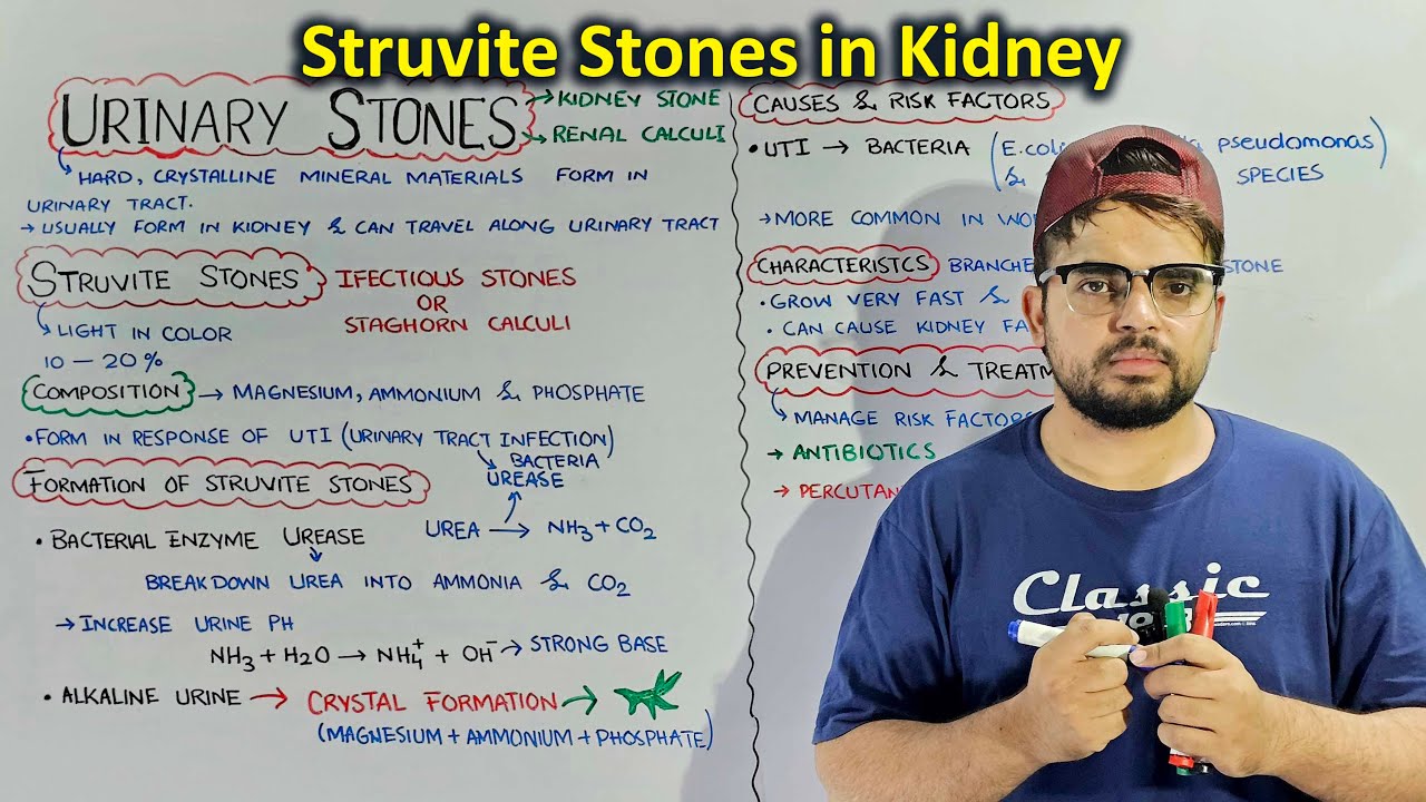Struvite Stones: A type of Kidney stones - YouTube