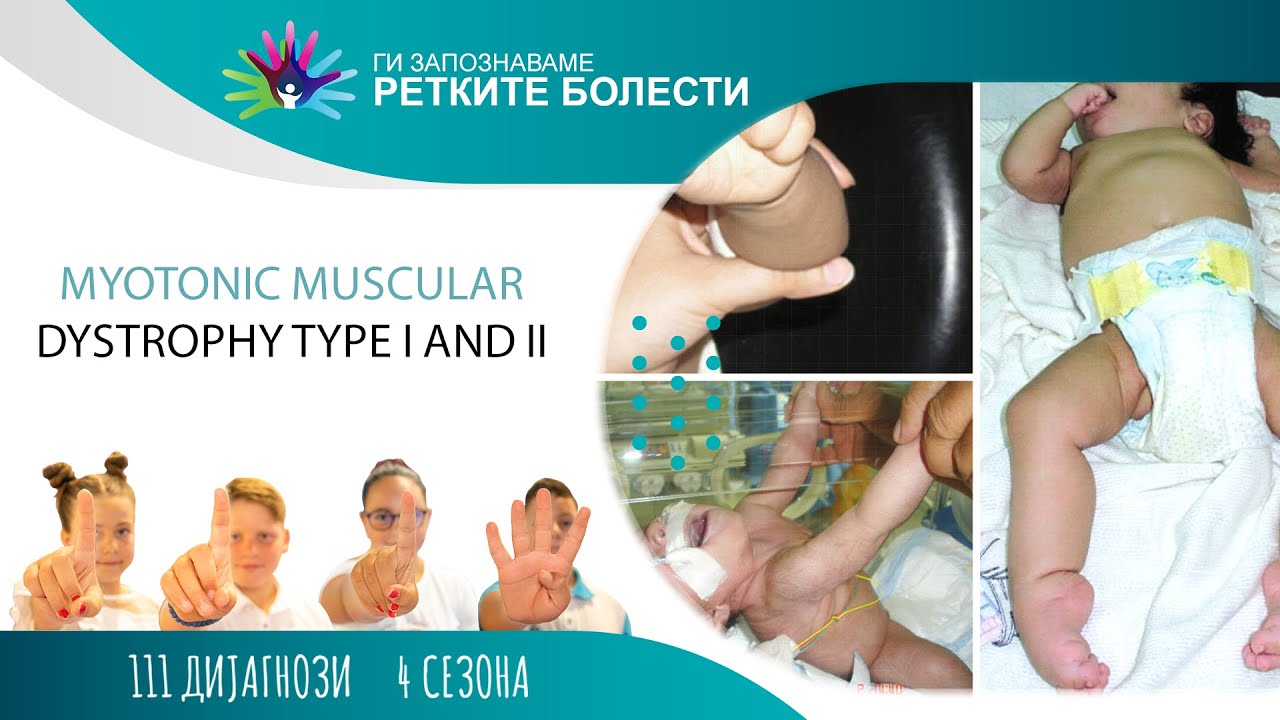 26 - Myotonic dystrophy type I and type II - YouTube